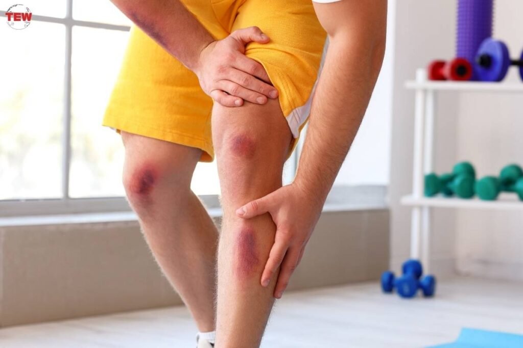 Different Types Of Slip and Fall Injuries | The Enterprise World